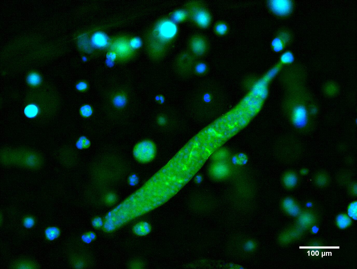電磁液滴プリントヘッドによる細胞のプリント - CELLINK Japan
