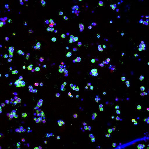 3D Bioprinting of Liver Mimetic Models with Regionally Varied Stiffness ...