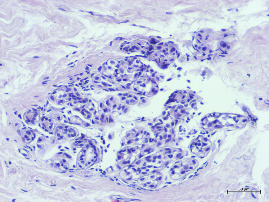 Carcinotech's Platform for Personal Cancer Care - CELLINK