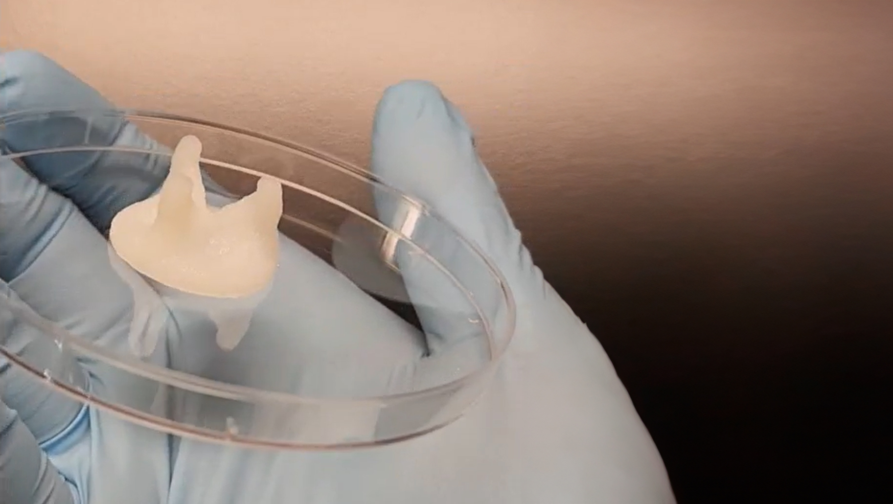 Bioprinted Pediatric Heart Valves by University of Montreal